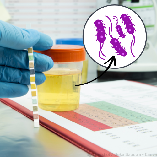 Escherichia coli im Urin Ursachen, Diagnostik, Behandlung