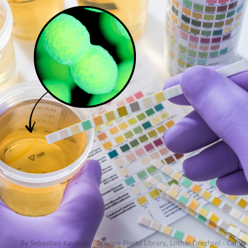 Enterokokken im Urin Ursache, Risiken, Diagnostik, Behandlung